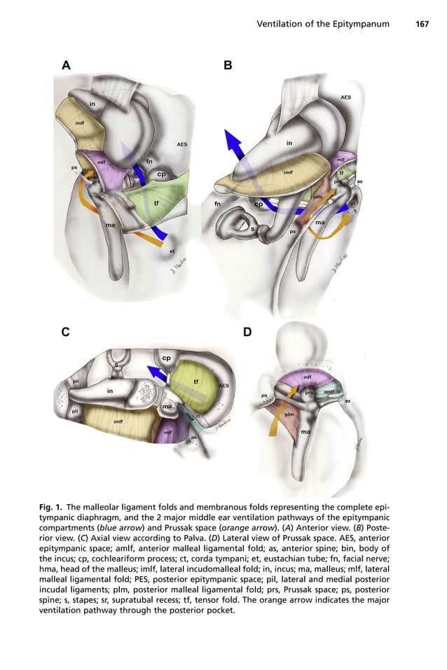 Epitympanic anatomy otolaryngology | PDF
