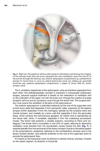 Epitympanic anatomy otolaryngology | PDF