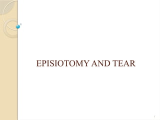 EPIZIOTOMY AND TEAR.power point presentationptx | PPTX