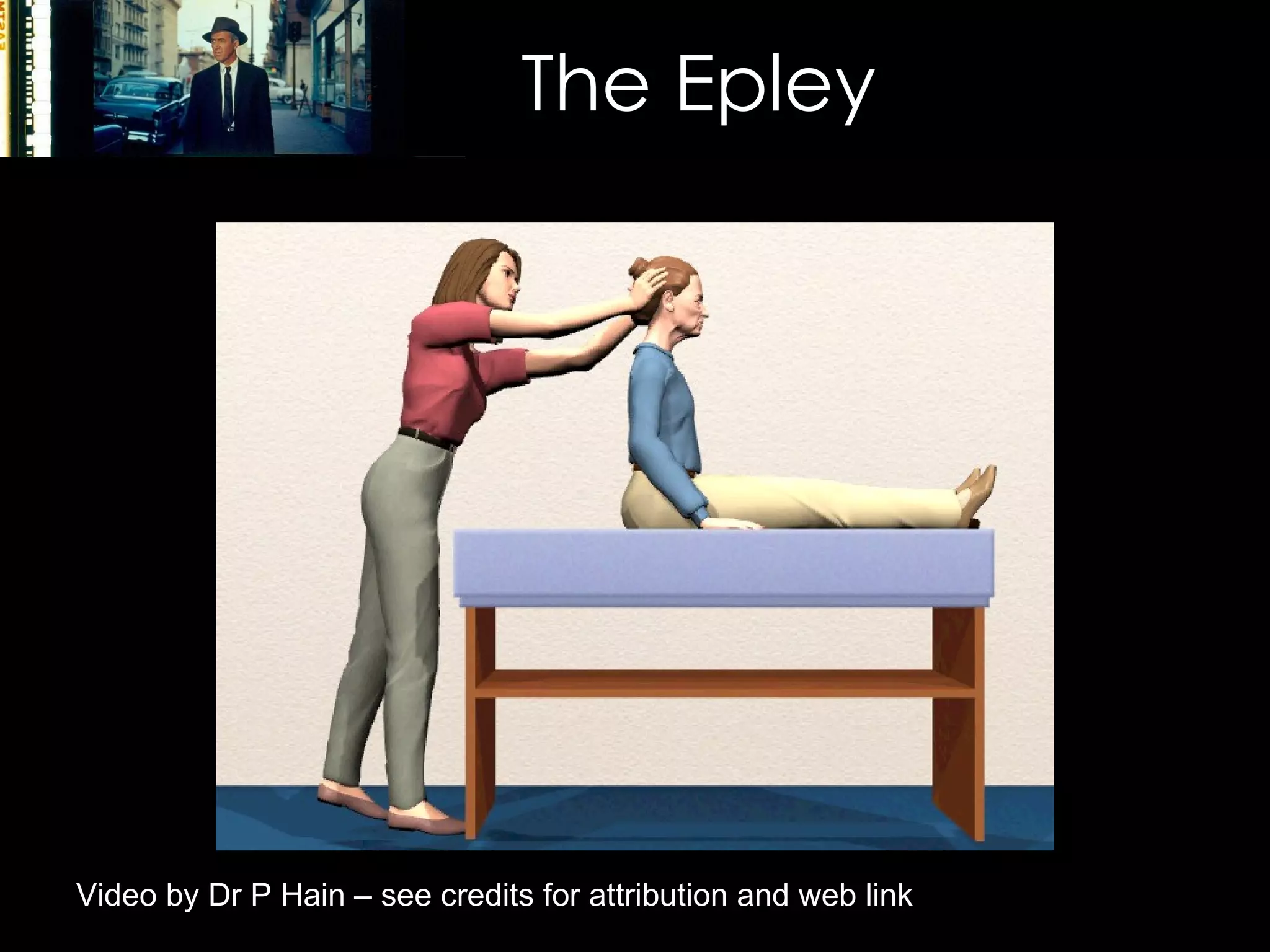 BPPV & The Epley Maneouvre / Maneuver | PPT