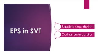 EP MEET EPS SUPRAVENTRICULAR TACHYCARDIA.pptx