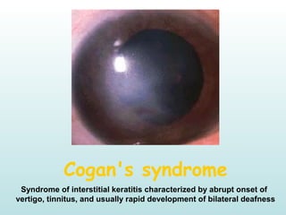 Ophthalmology Eponyms ! | PPT