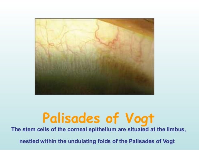 Ophthalmology Eponyms