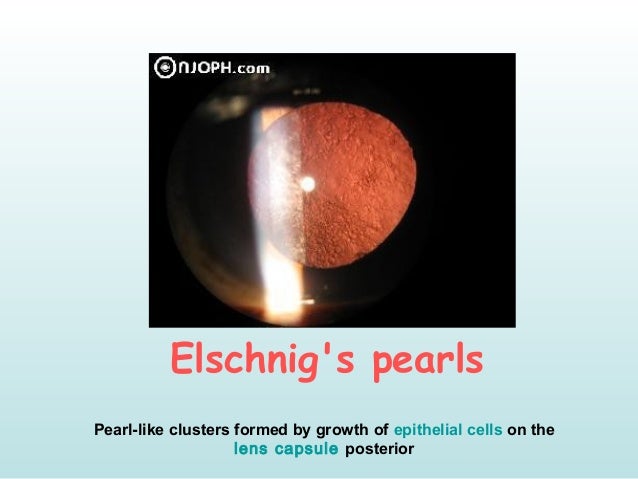 Ophthalmology Eponyms