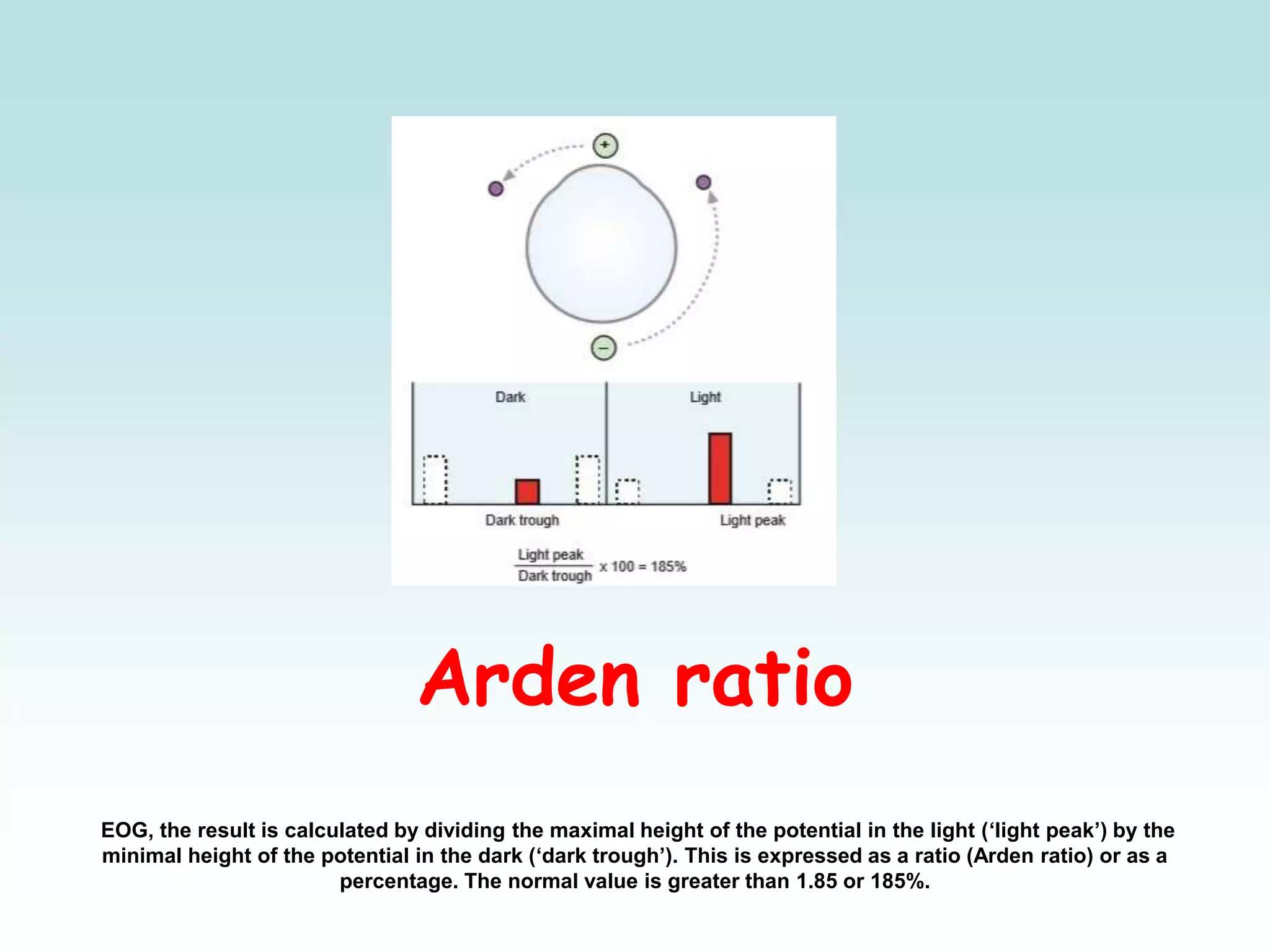 Ophthalmology Eponyms IV ! | PPT