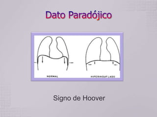 Epoc | PPTX