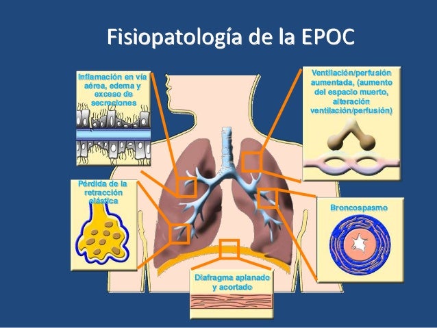 EPOC