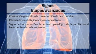 EPOC | PPT