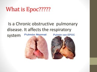Epoc | PPTX