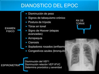 Epoc enfisema bronquitis crónica,bronquiectasia y asma | PPTX