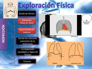 Enfermedad Pulmonar Obstructiva Crónica- Caso Clínico | PPTX