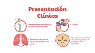EPOC Enfermedad Pulmonar Obstructiva Crónica.pdf