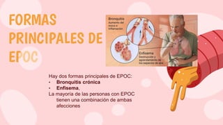 EPOC enfermedad pulmonar obstructiva cronica | PPTX