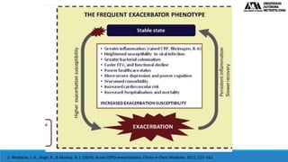 Epoc exacerbado. Diagnostico y Tratamiento | PPTX