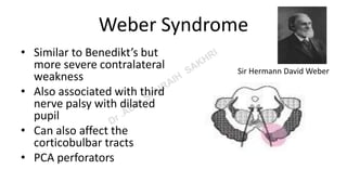 Weber Syndrome Midbrain