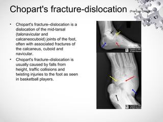 eponymousfractures-160228213145.pdf