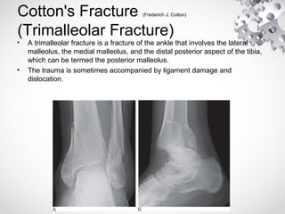 eponymousfractures-160228213145.pdf