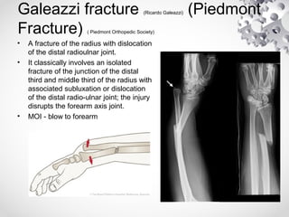 eponymousfractures-160228213145.pdf