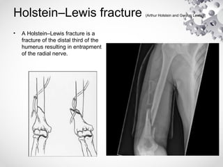 eponymousfractures-160228213145.pdf