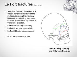 eponymousfractures-160228213145.pdf