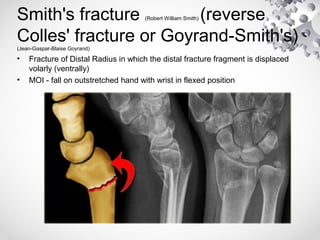 eponymousfractures-160228213145.pdf