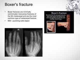 eponymousfractures-160228213145.pdf