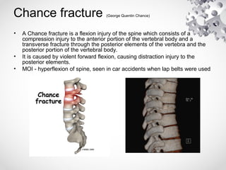eponymousfractures-160228213145.pdf