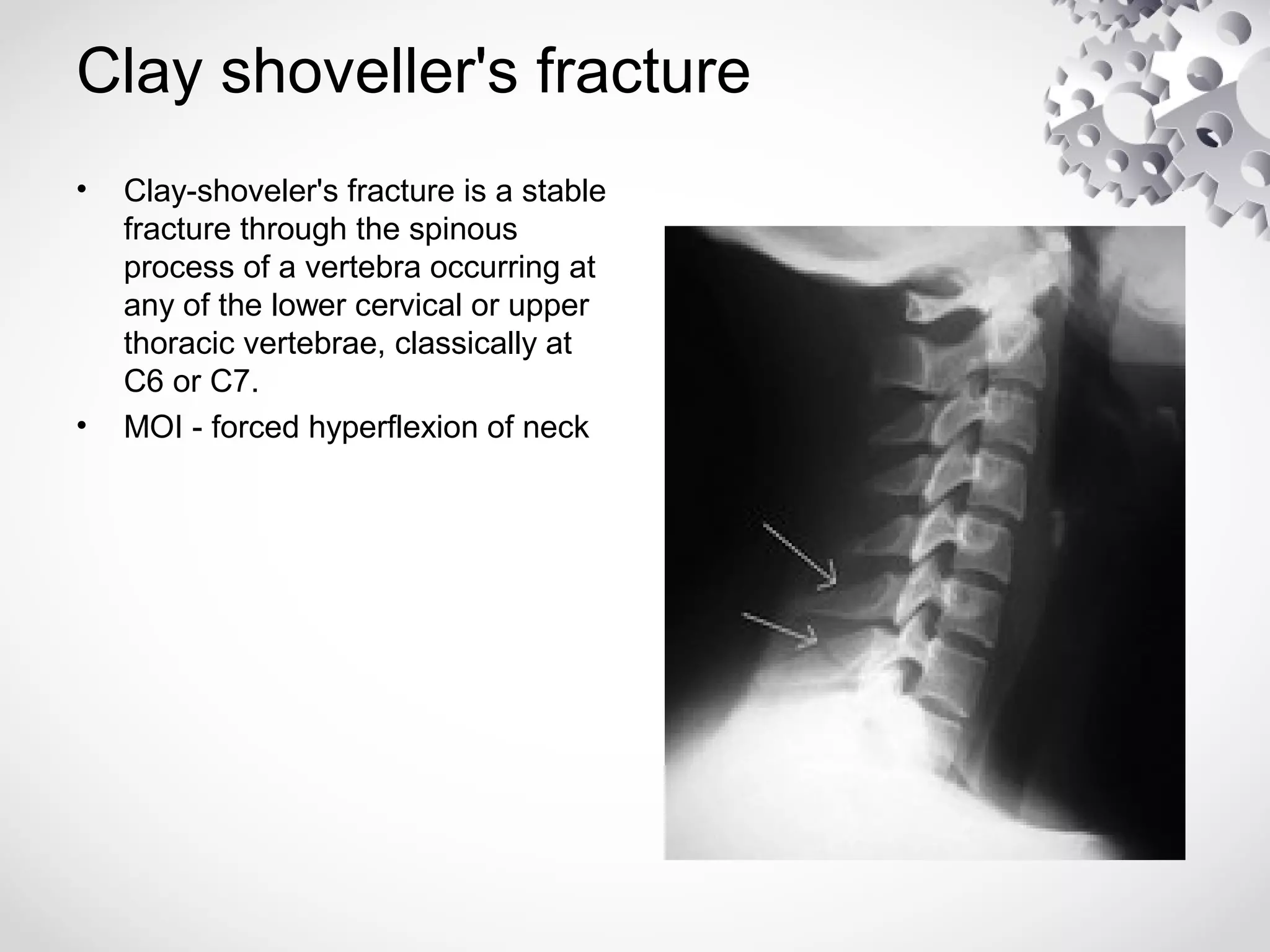 Eponymous fractures | PPT