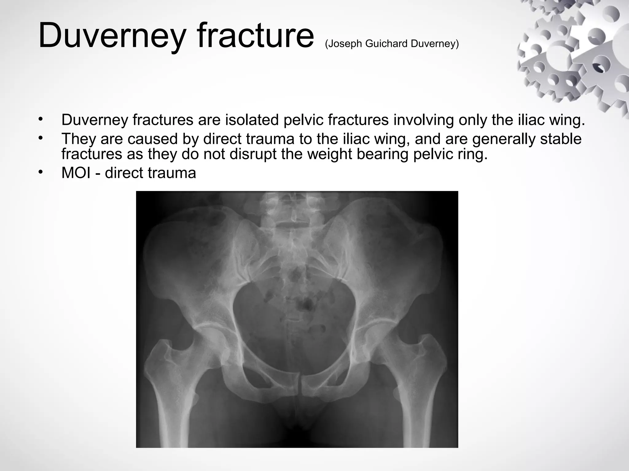 Eponymous fractures | PPT