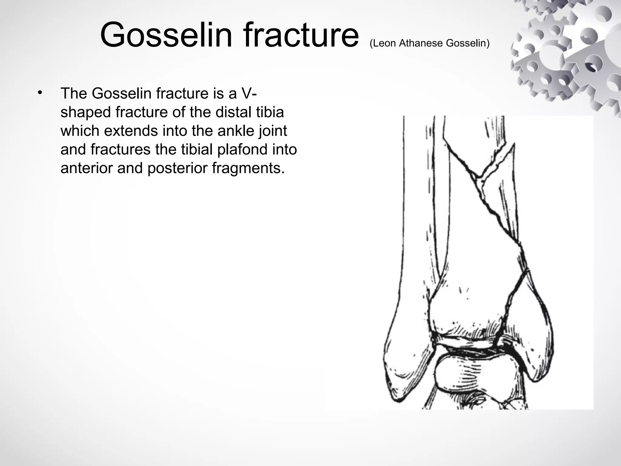 Eponymous fractures | PPT