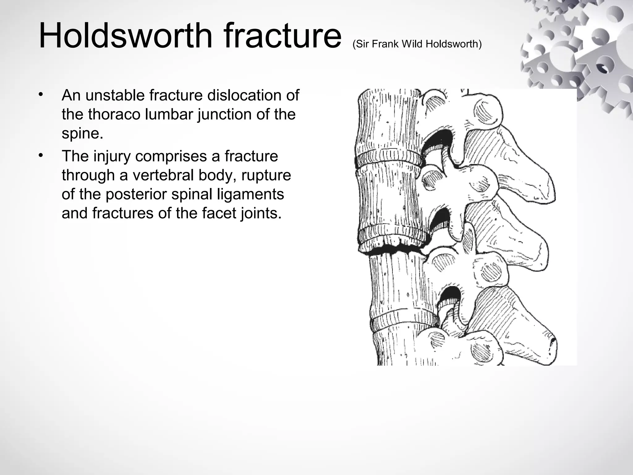 Eponymous fractures | PPT
