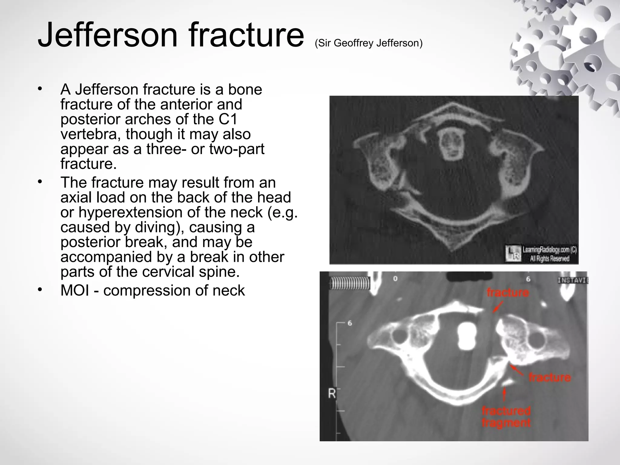 Eponymous fractures | PPT