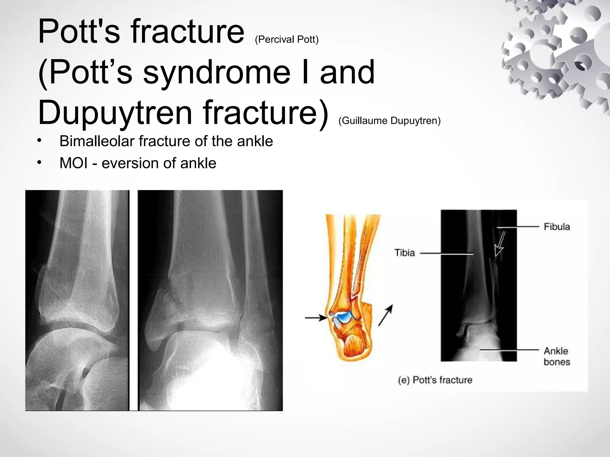 Eponymous fractures | PPT