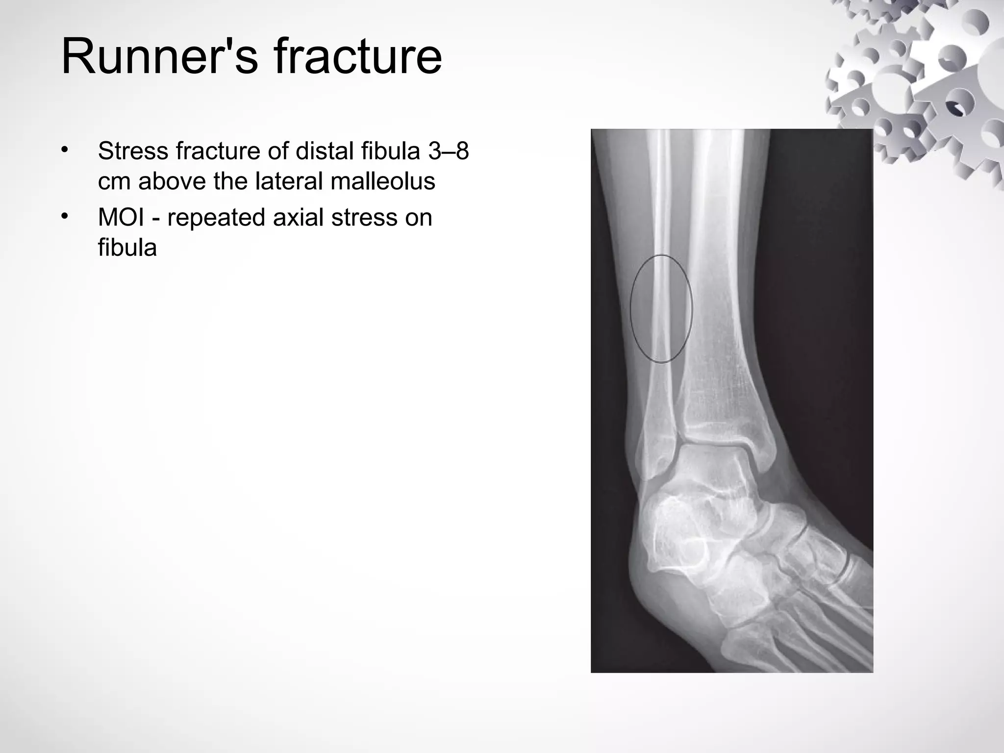 Eponymous fractures | PPT