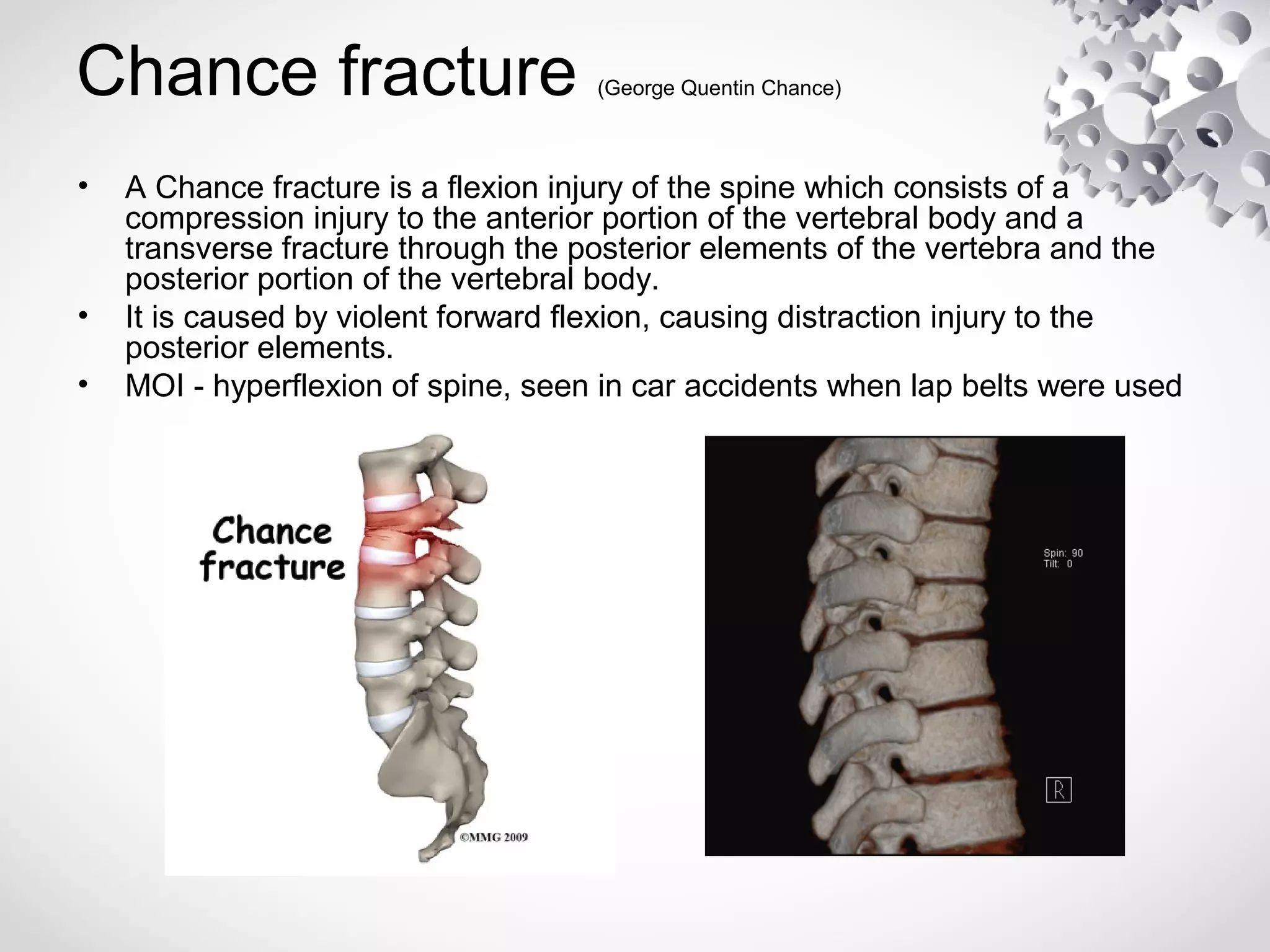 Eponymous fractures | PPT