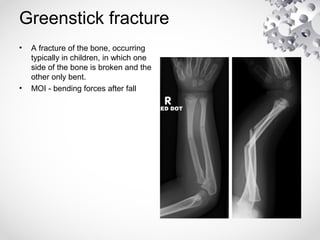 Eponymous fractures | PPT