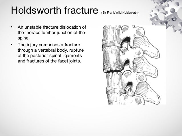 Eponymous fractures