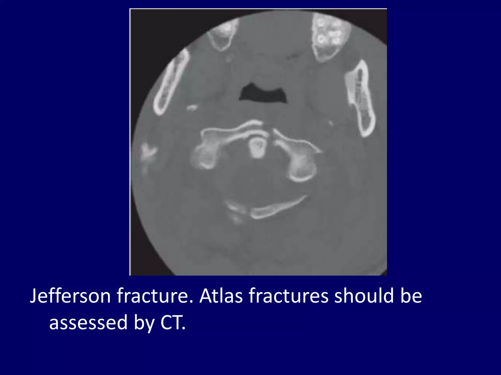 Eponymous fractures name Dr. muhammad Bin Zulfiqar | PPTX