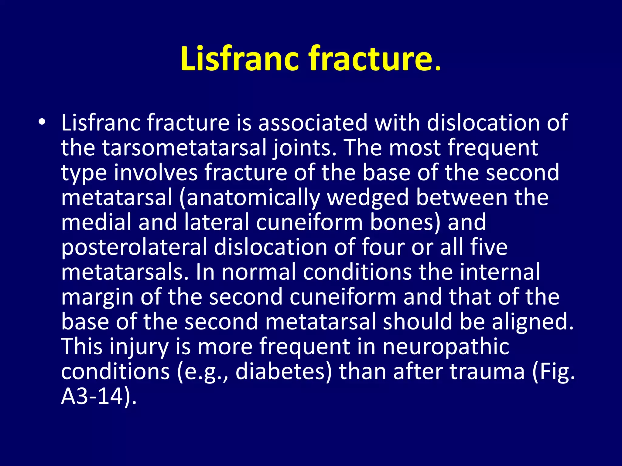 Eponymous fractures name Dr. muhammad Bin Zulfiqar | PPTX