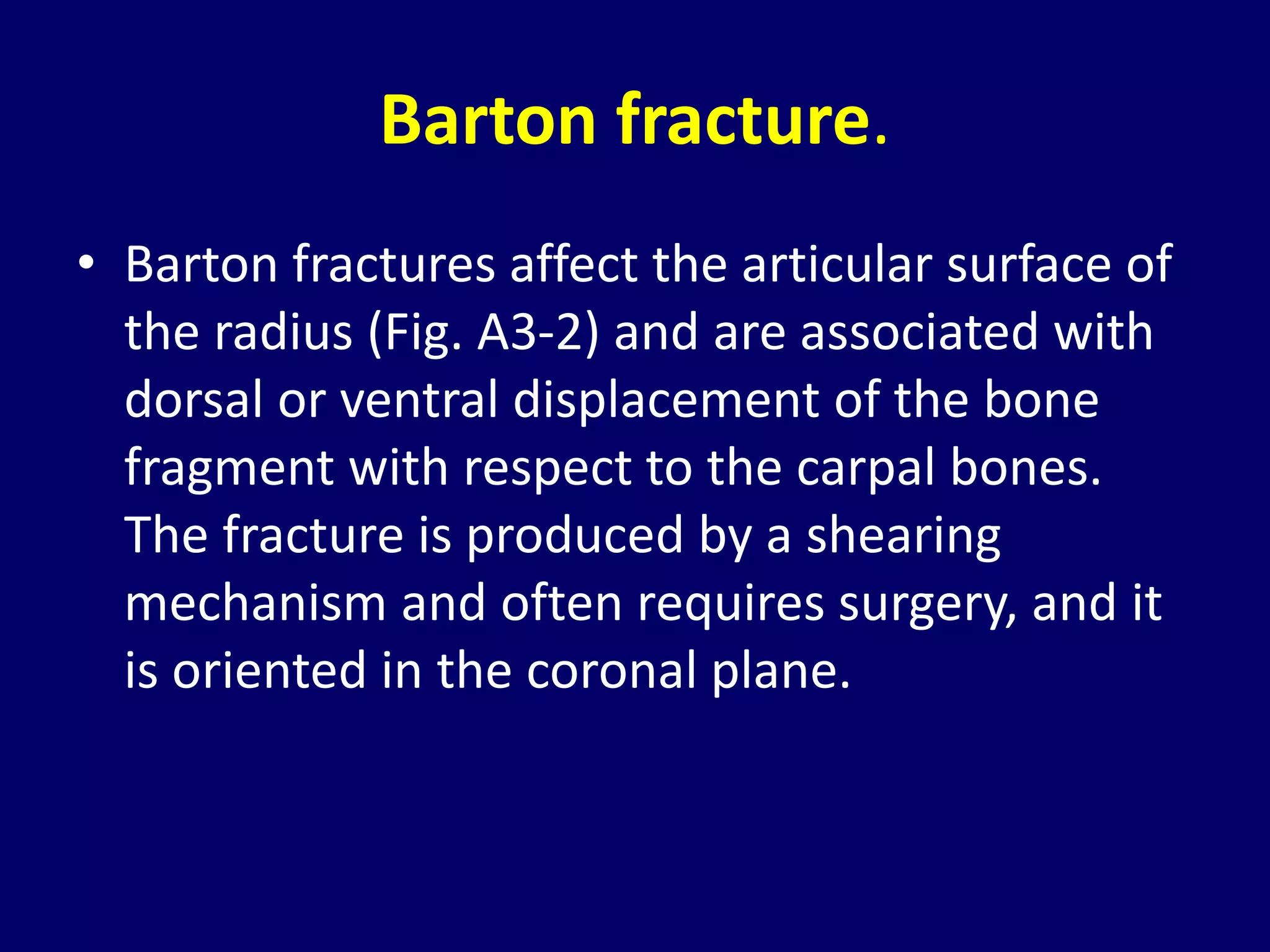 Eponymous fractures name Dr. muhammad Bin Zulfiqar | PPTX