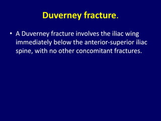Duverney Fracture