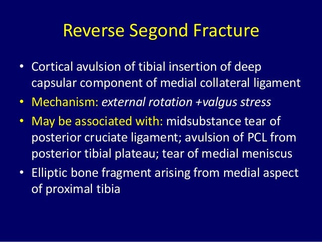 Eponymous Fractures Name Dr Muhammad Bin Zulfiqar Strategic Studies