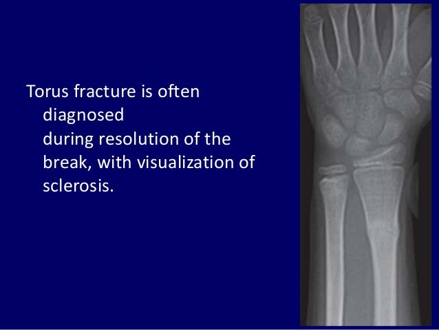 Eponymous Fractures Name Dr Muhammad Bin Zulfiqar Strategic Studies