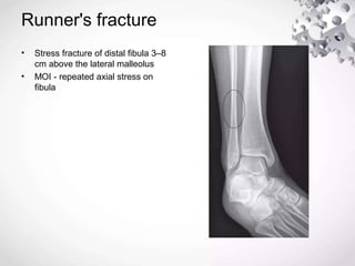 Eponyms in orthopaedics - fractures.pptx