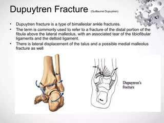 Eponyms in orthopaedics - fractures.pptx