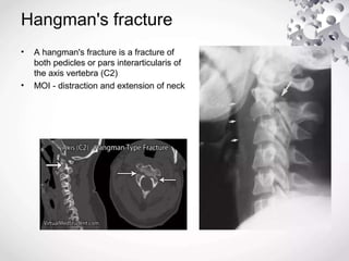 Eponyms in orthopaedics - fractures.pptx