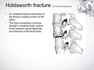 Eponyms in orthopaedics - fractures.pptx