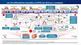 Tratamiento biológicos en enfermedad pulmonar obstructiva crónica (EPOC ...