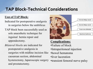Severe Kyphoscoliosis with Inguinal Swelling excision underUSG guided ...