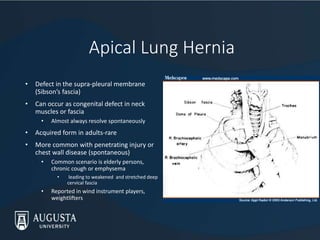 Interesting cases of lung hernias | PPTX
